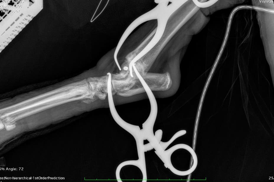 Precise imaging and unconventional fixation resolve challenging tarsal ...
